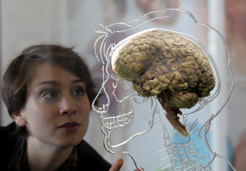 Significant brain-scan study illuminates differences in male and female ...