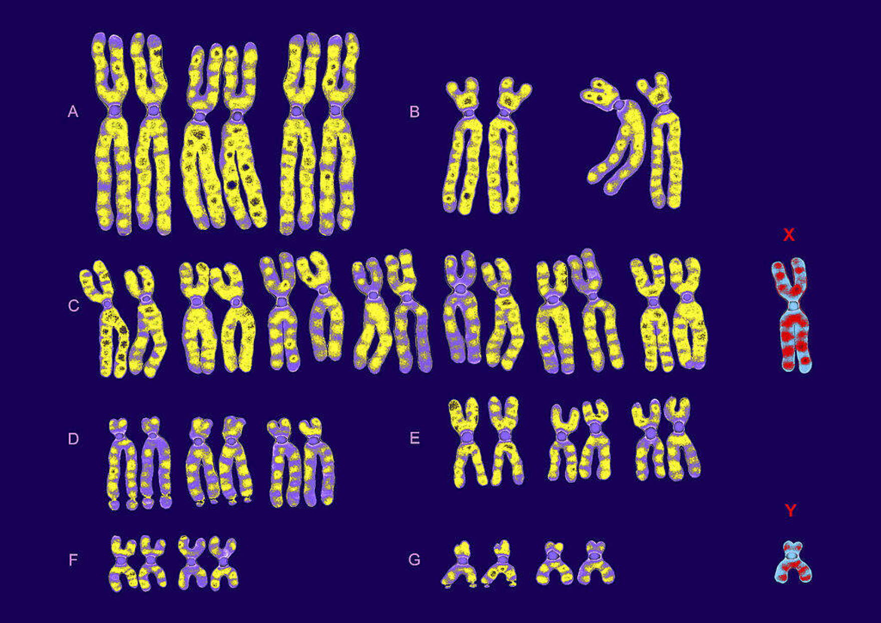 Unraveling the secrets of the human Y chromosome | LAist